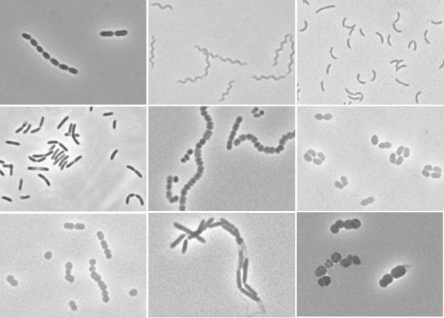All About Rumen Microbiology - Vet Extension
